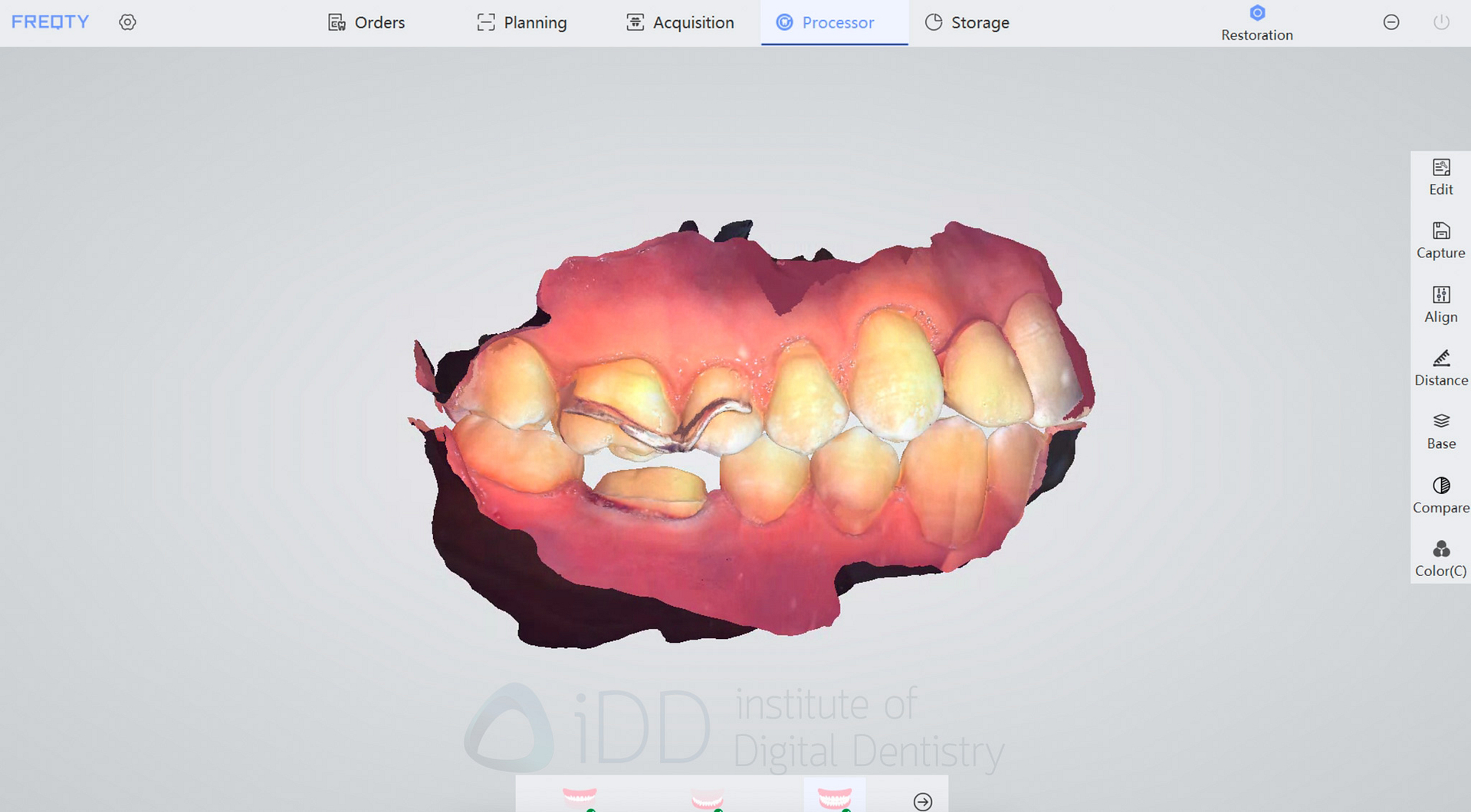 Panda SMART Intraoral Scanner Review by iDD